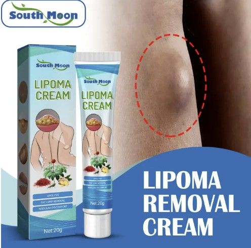 Lipoma Removal Cream Lipolysis Fat Lump Relieve Plaster Skin Swelling ...