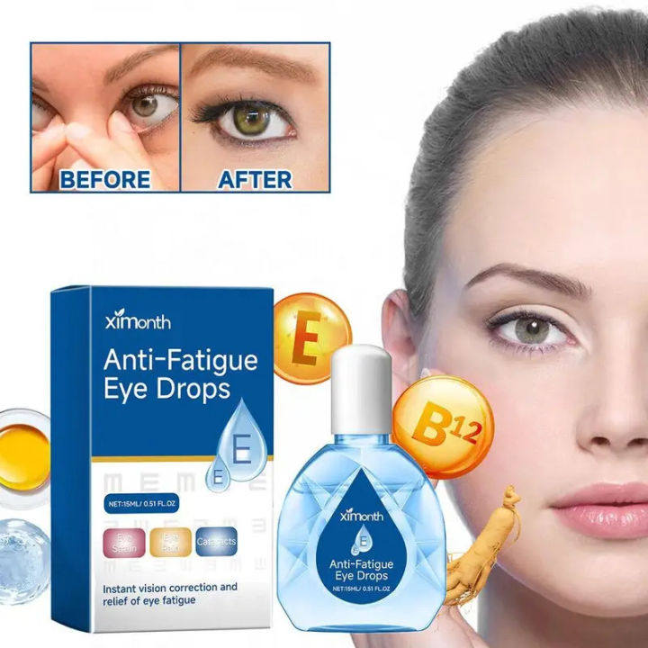 Anti Fatigue Eye Drops 15ml High Quality Eye Drops Relieve Itchy Discomfort Eyes Clean Vision ...