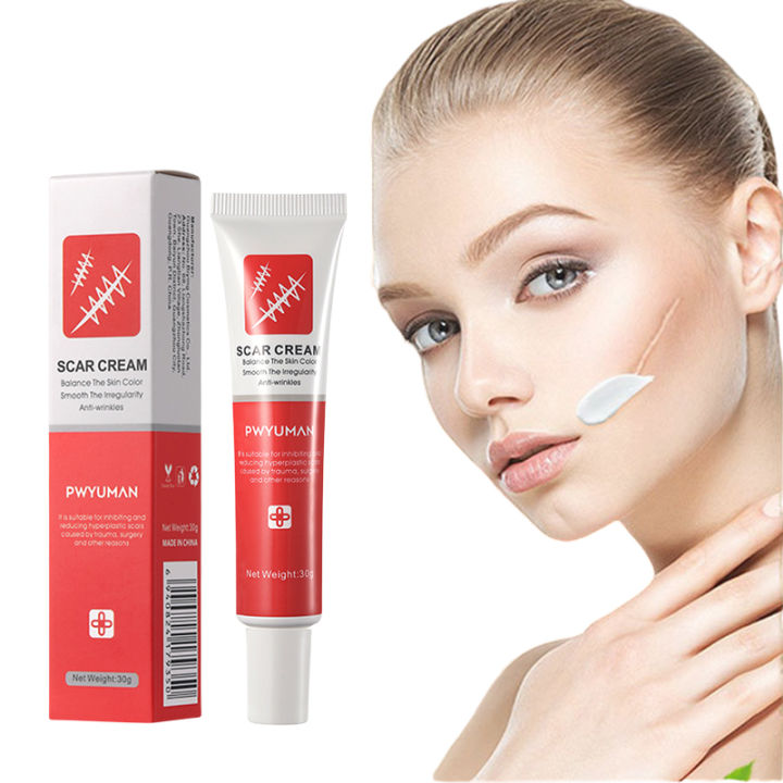 Scar Removal Ointment Stretch Marks Permanent Removal Burn Acne Mark ...