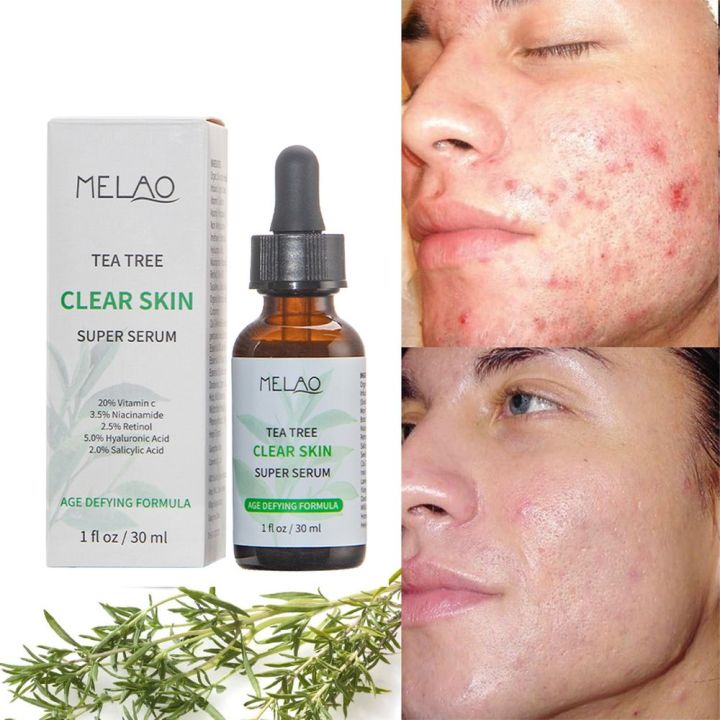 MELAO TEA TREE CLEAR SKIN SUPER SERUM-30ML | Daraz.com.bd