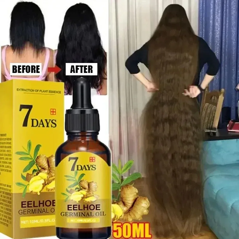 Fast Hair Growth Oil Ginger Growth Hair Treatment Anti Hair Loss Men ...