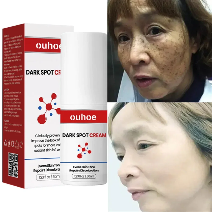 Dark spot remover cream, lightening body lotion, lightening melanin repair, moisturizing polish ...