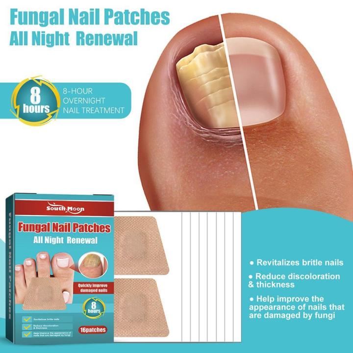 16pcs Nail Treatment Patch Anti Fungal Nail Correction Stickers Ingrown ...