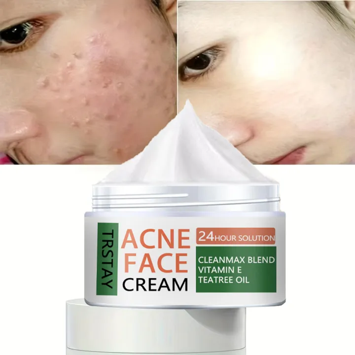24 hour solution to acne face cream CLEANMAX mixed vitamin E tea tree ...
