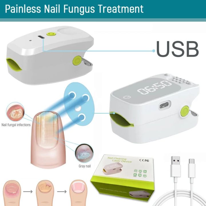 905NM Nail Fungus Laser Nail Treatments Device USB Charging Light ...
