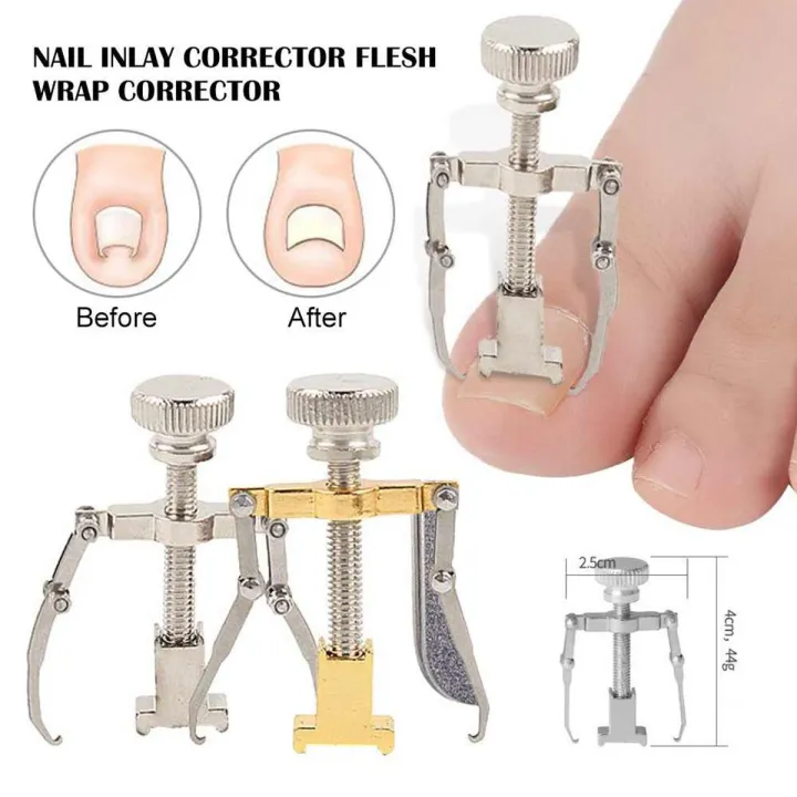 Ingrown Toe Nail Fixer Pedicure Toenail Recover Nail Correction Tool ...