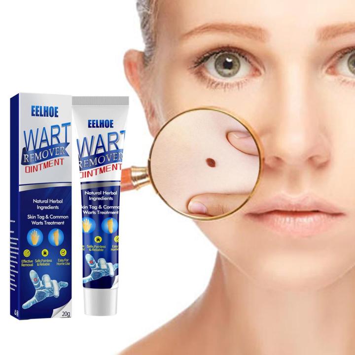 Warts Remover Ointment Wart Treatment Cream Skin Tag Remover Ointment ...