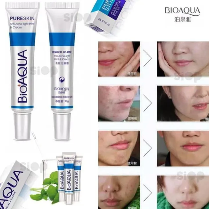 Bioaqua Face S-Kin Care Acne Anti-Rinkle Removel Cream Spots Scar ...