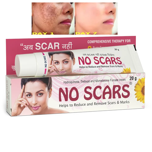 No Scars Cream 20g Helps To Reduce and Romove Scars & Marks | Daraz.com.bd
