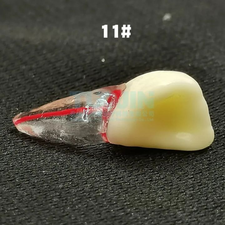 2PCS Dental Endodontic Tooth Model Endo Teeth With Colored Root Canal ...
