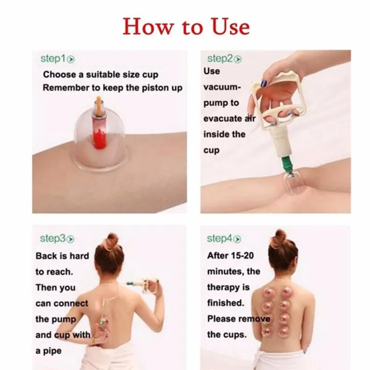 Hijama/ Cupping/ Sunnah Therapy 1 Set with 32pcs Cup ACU Hijama Caping ...