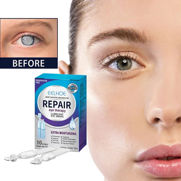 Eye Drop Improve Eyesight Protection Relieve Eyes Fatigue Dry Itchy ...