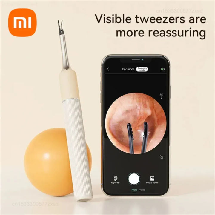 Xiaomi Intelligent Visual Ear Sampling Forceps Ear Wax Cleaner Remover ...