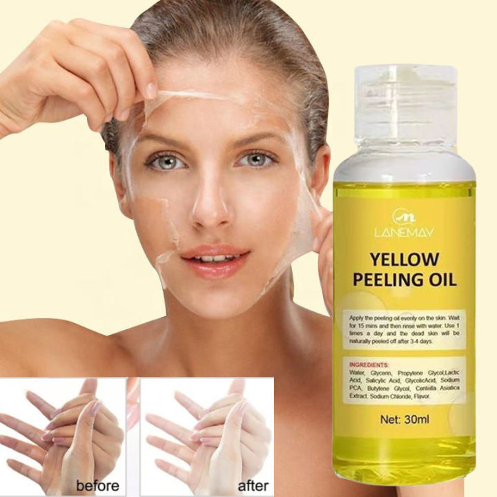 Yellow Peeling Oil For Dark Skin Bleaching Exfoliating For Face ...