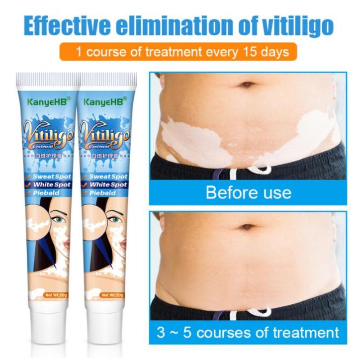 White Tag Cream Treatments Gently Repair Moisturizing Cream Reduces ...