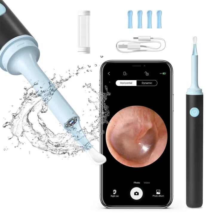 【Must-Have Gadgets】 KERUI Smart Visual Ear Cleaner Spoon Safe Endoscope ...