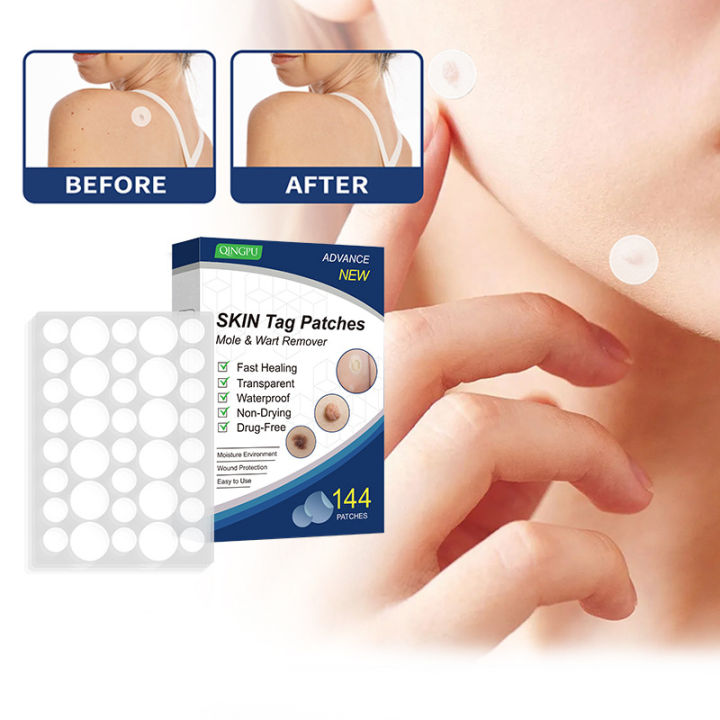 144pcs Box Invisible Acne Patch Wart Patch Remover Pimple Patch Anti Acne Spots Marks Concealer