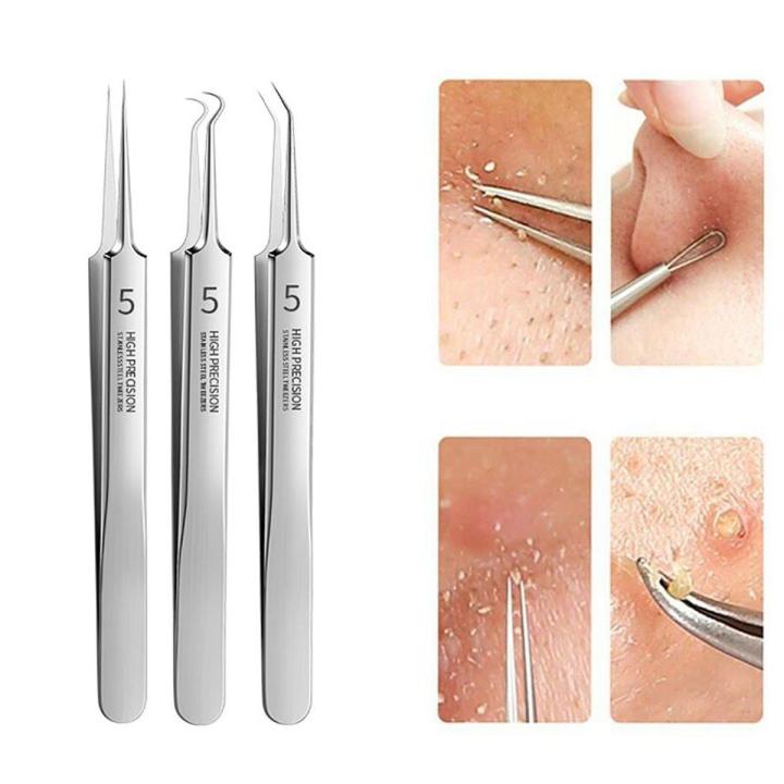 3PCS Ultra-fine No. 5 Pimples Blackhead Clip Special Scraping & Acne ...