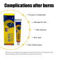 20g Scald Burn Cream Analgesic Ointment Moisturizing Medical Effective ...