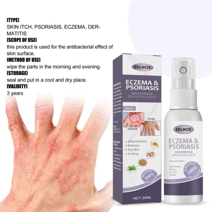 Tinea Pedis Spray Eczema Ointment Scalp Psoriasis Hand Tinea Foot Odor ...