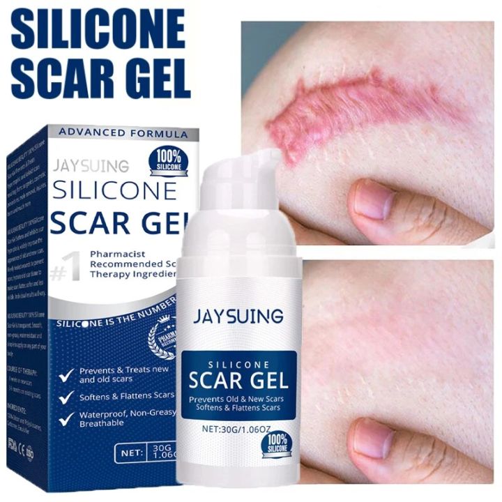 100% Silicone Scar Removal Cream Gel Burn Surgical Scar Cesarean Scar ...