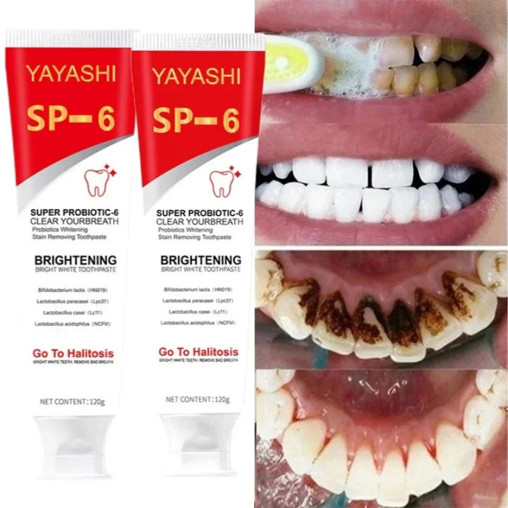 SP-6 Whitening Tooth Remove Plaque Stains Probiotic Toothpaste Teeth ...