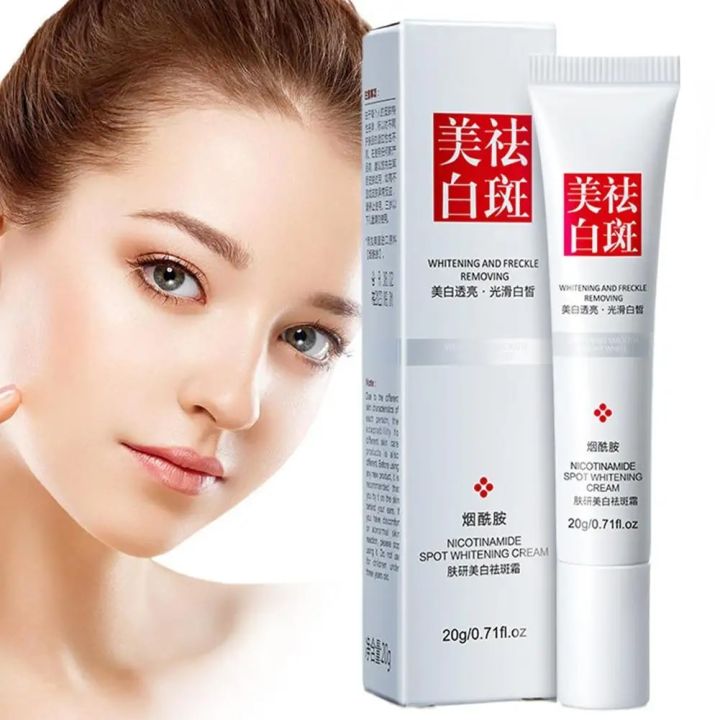 Whitening Freckles Cream Remove Melasma Dark Spot Acne Marks Lightening ...