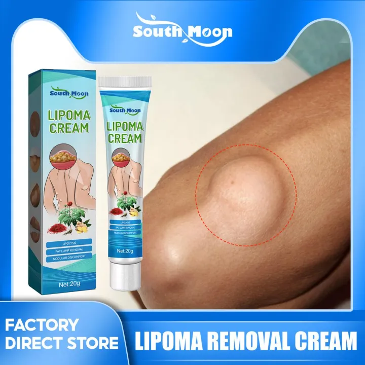 【100% Authentic】South Moon Lipoma Removal Cream Lipolysis Fat Lump ...
