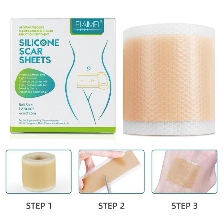 【Thriving】 Scar Repair Gel Patch Tape 150cm Treatment For Trauma Burn ...