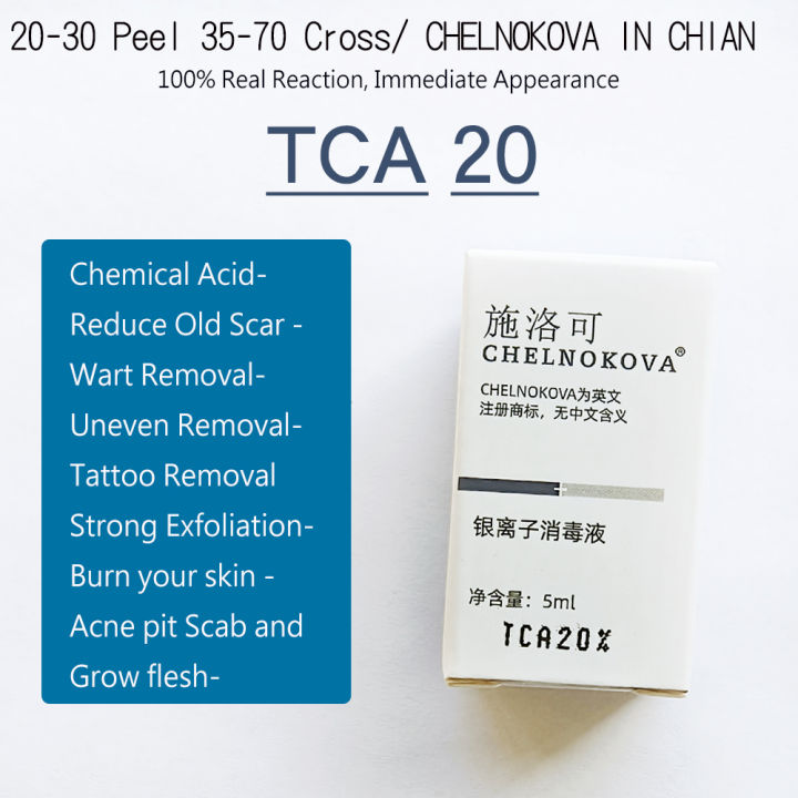TCA 20% 30% 35% 40% 50% 60% 70% Pure TCA Peel Solution for Sun Damage ...