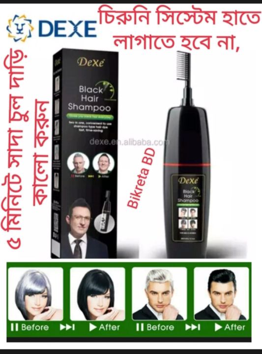 Dexc black hair shampoo U K 200 ml curine system, | Daraz.com.bd