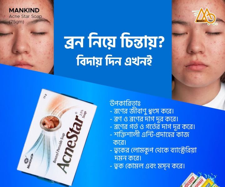 Acne Star Soap 75gm | Daraz.com.bd