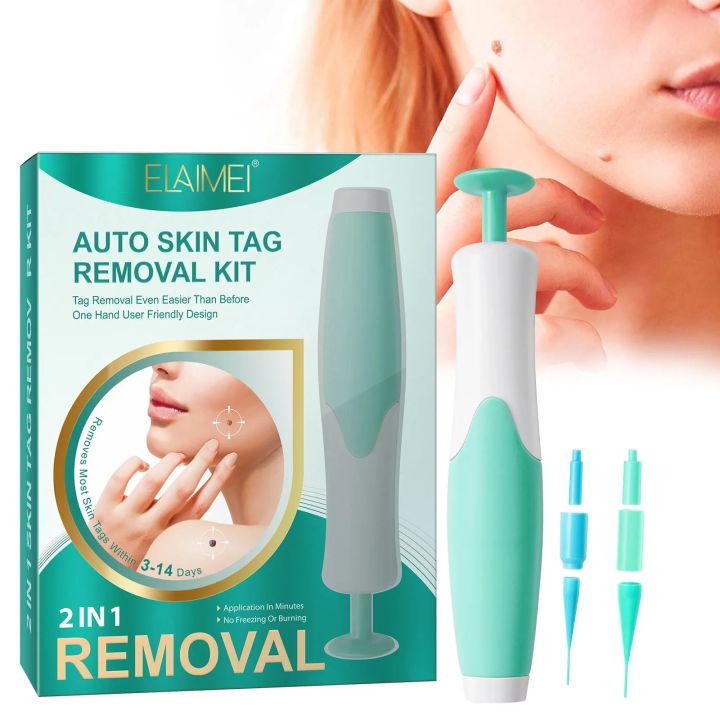 Auto Skin Tag Removal Kit 2-8mm Band Painless Mole Wart Skin Tag ...