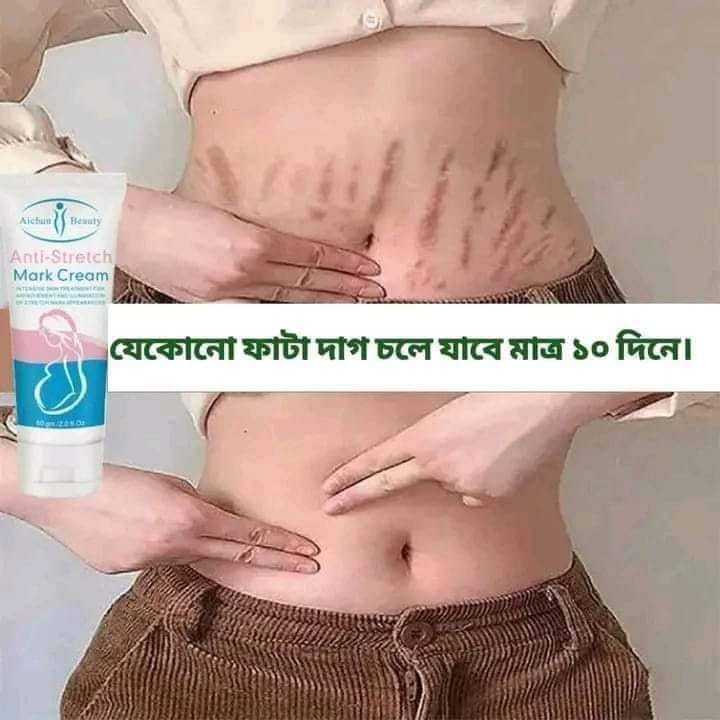 Aichun Beauty Anti-Stretch Mark Cream 60g | Daraz.com.bd