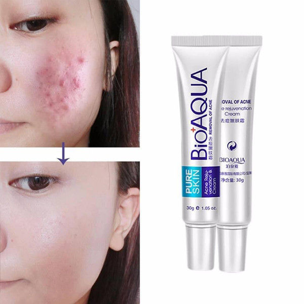 BIO Aqua Acne Anti-Wrinkle Removal Marks Cream 30g | Daraz.com.bd