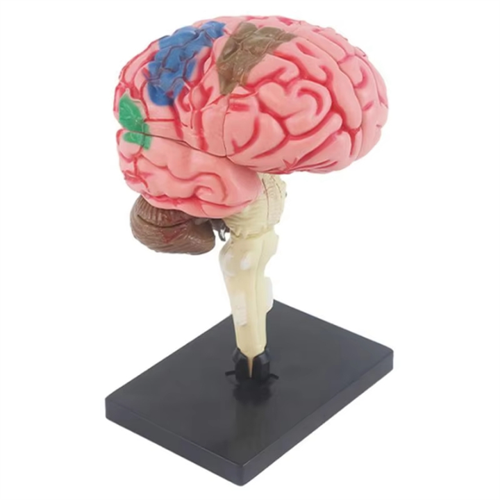 New 4D Human Brain Model Kids Scientific Medical Teaching Anatomical ...