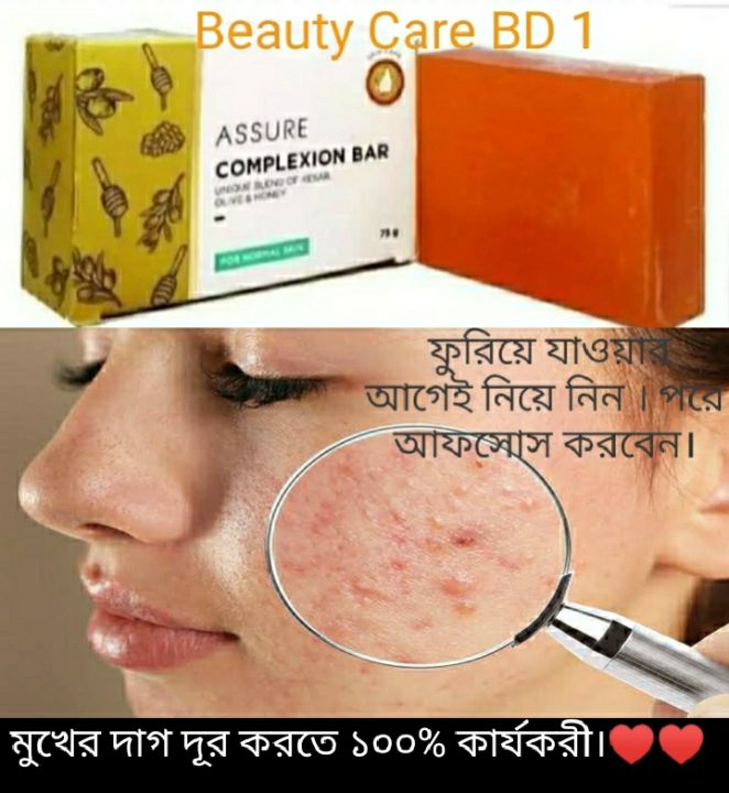 Assure Complexion Soap 75g India | Daraz.com.bd