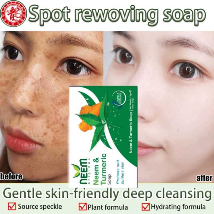 Neem Face and Body Ltch-Free number one soap – Acne, Eczema 80G made in ...