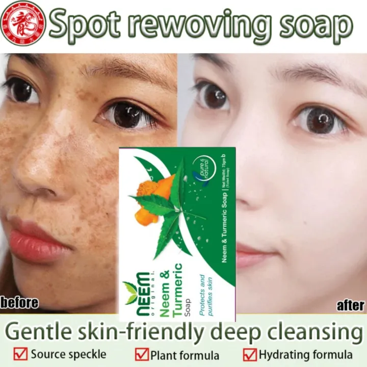 Neem Face and Body Ltch-Free number one soap – Acne, Eczema 80G made in ...