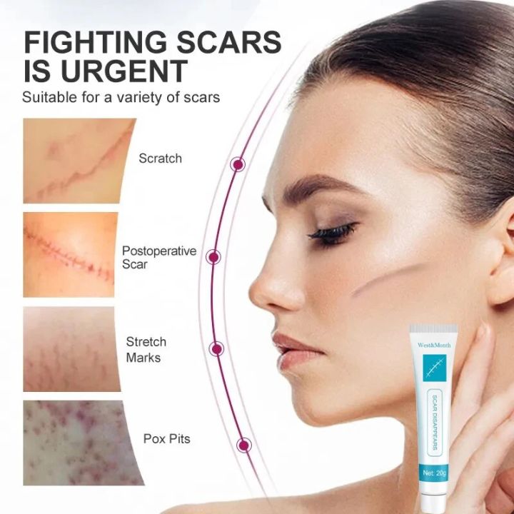 Scar Removal Cream Fast Remove Scars Effectively Treat Skin Surgery ...