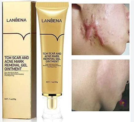 TCM Scar and Acne Mark Removal Gel Ointment 30g | Daraz.com.bd