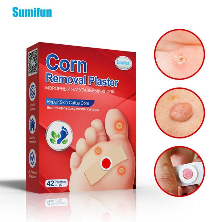 42PCS Foot Corn Removal Plaster Produced By Chinese Traditional Medicie ...