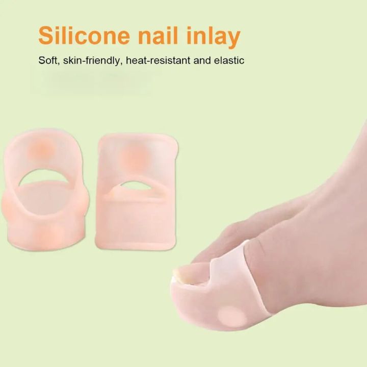 Ingrown Toe Nail Correction Tool Toenail Straightening Tool Repair Kit ...