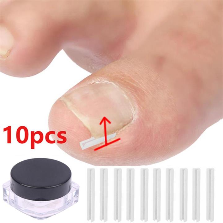 New 10Pc Ingrown Toenail Corrector Toe Foot Nail Correction ticker ...
