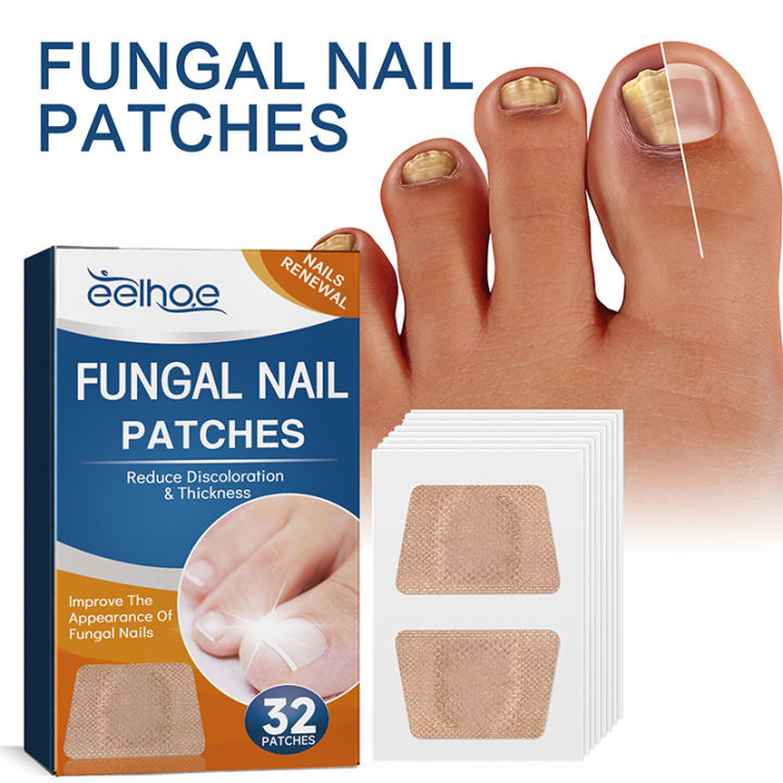 32Pcs Nail Treatment Patch Anti Fungal Nail Correction Stickers Ingrown ...
