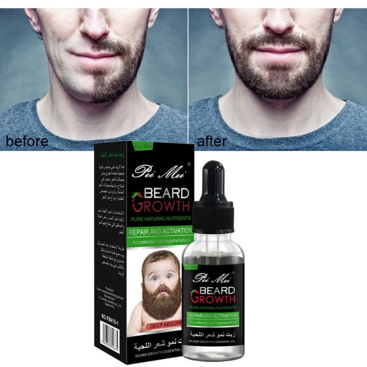 【Tech-savvy】 Men Beard Growth Kit Soften Hair Growth Nourishing ...