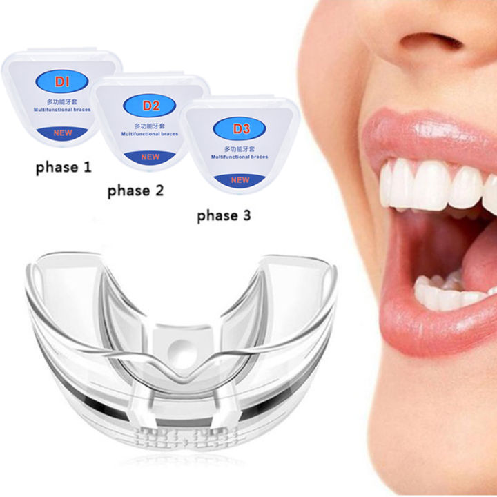 Dental Braces Orthodontic Tooth Alignment Tool Teeth Grinding Guards ...