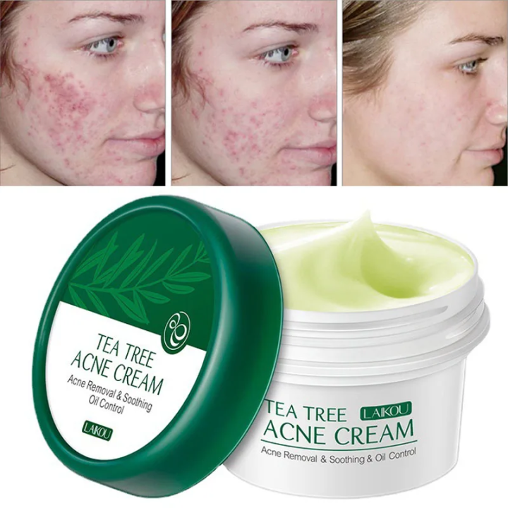 LAIKOU Tea Tree Anti-Acne Cream Effective Acne Removal Cream Acne ...