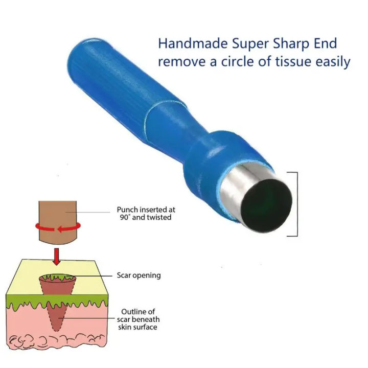 Reusable Biopsy Punches Piercing Trephine Stainless Steel Dermal ...