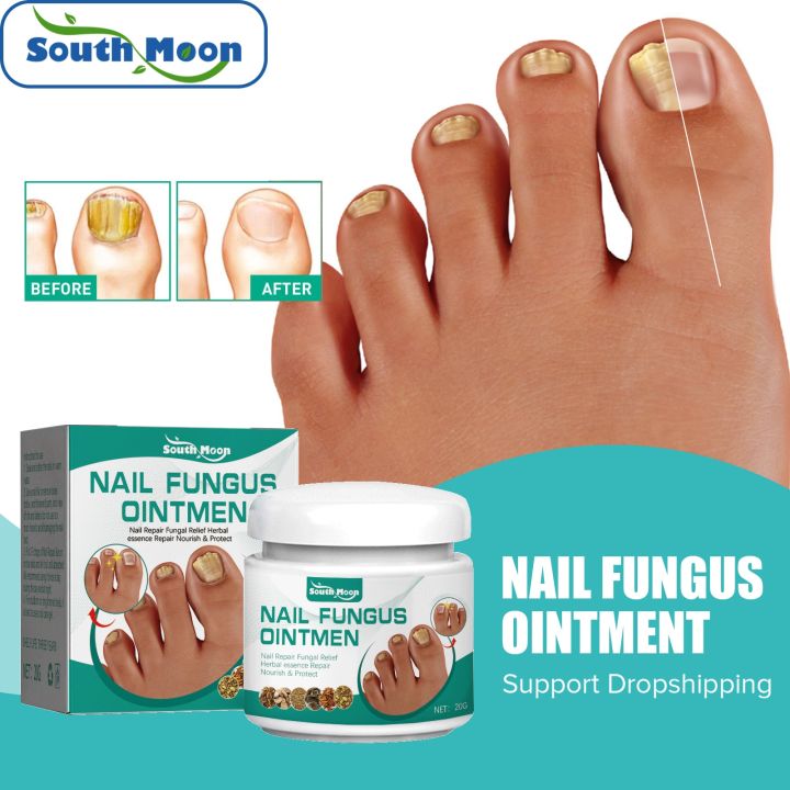 South Moon Nail Fungus Treatment Cream Fast Recovery Onychomycosis ...